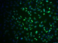 SCp2 Mouse Mammary Epithelial Cell Line | SCC458
